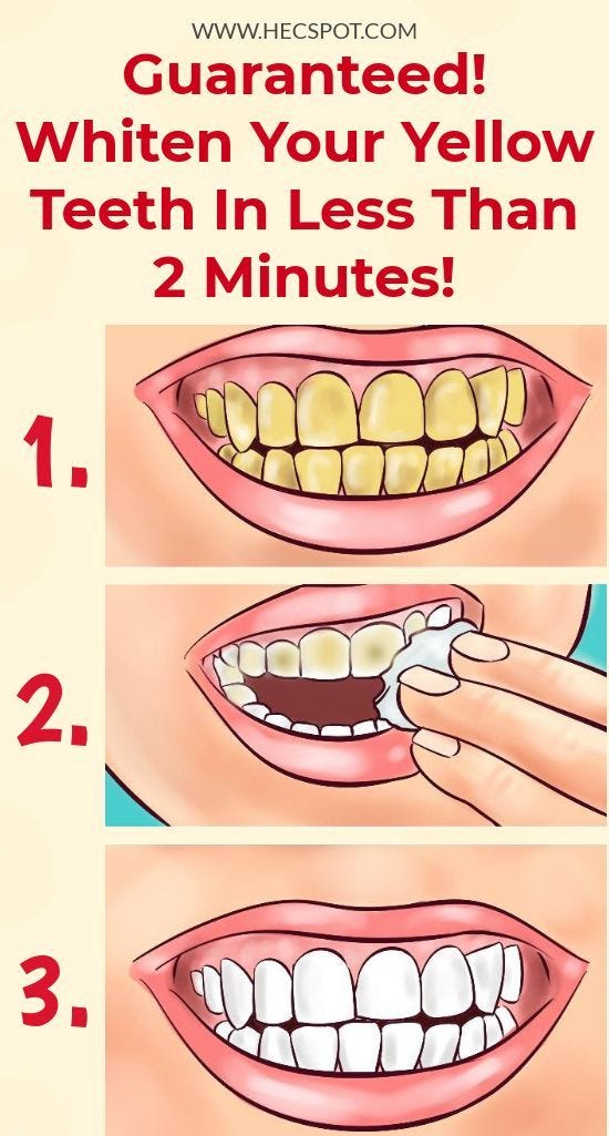 GUARANTEED! Whiten Your Yellow Teeth In Less Than 2 Minutes! - Olivia ...