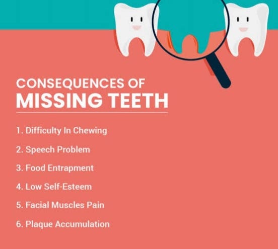 Consequences of Missing Teeth and Replacement Options at Kiran Dental ...