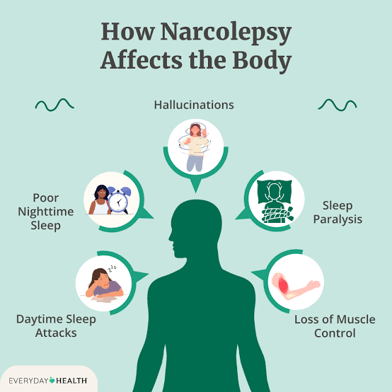 Narcolepsy, Sleep, and Me. I’m the friend who’s always sleepy. As… | by Ayzal Salman | Sep, 2024 ...