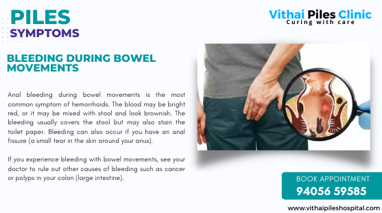 Piles Symptoms - Vithaipiles - Medium