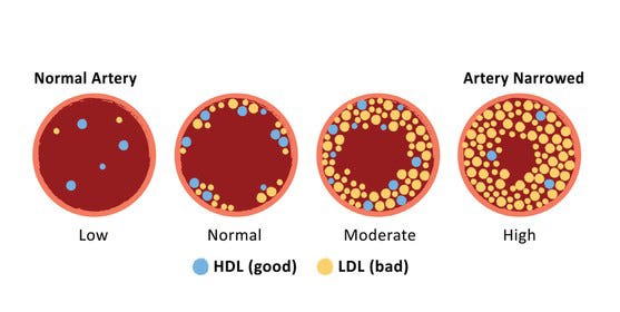Hdl