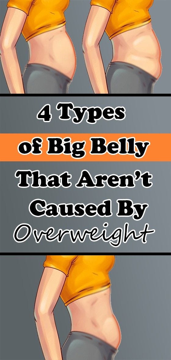 4 types of big belly that aren’t caused by overweight - Janell luyah ...