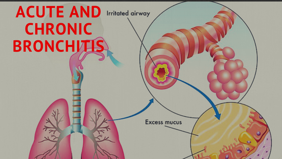 ACUTE AND CHRONIC BRONCHITIS. Bronchitis is a respiratory disease… | by ...