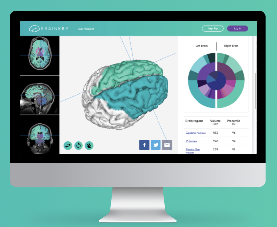 Can neurotech help those living with multiple sclerosis? | by Jen ...
