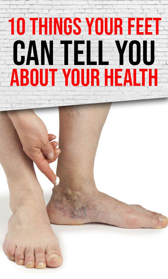 What Your Feet Say about Your Health: 10 Warning Things to Pay ...