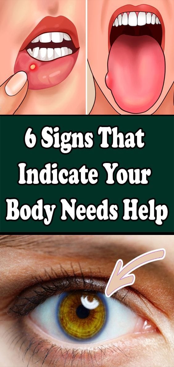 6 signs that indicate your body needs help - Cerys green - Medium