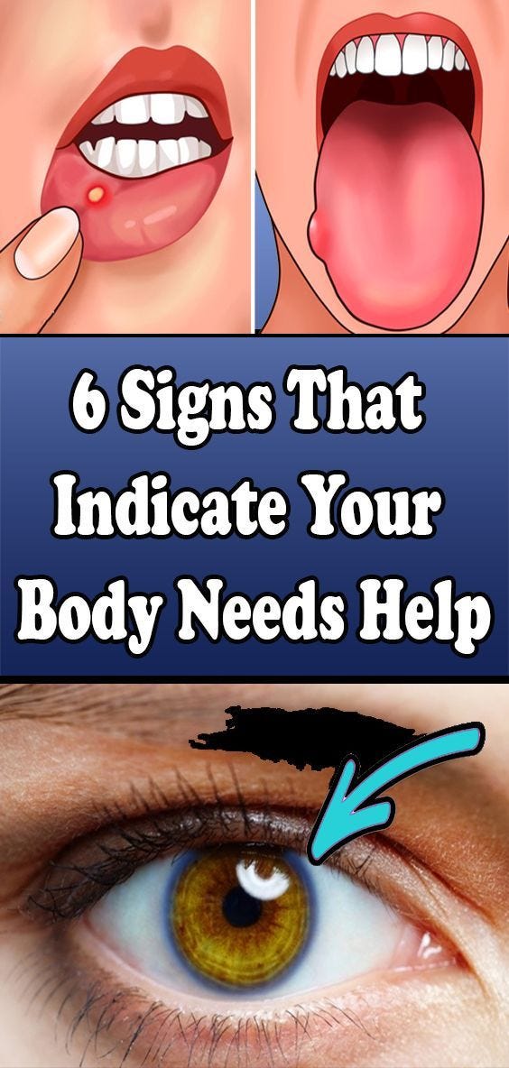 6 signs that indicate your body needs help - Marlenne laticia - Medium