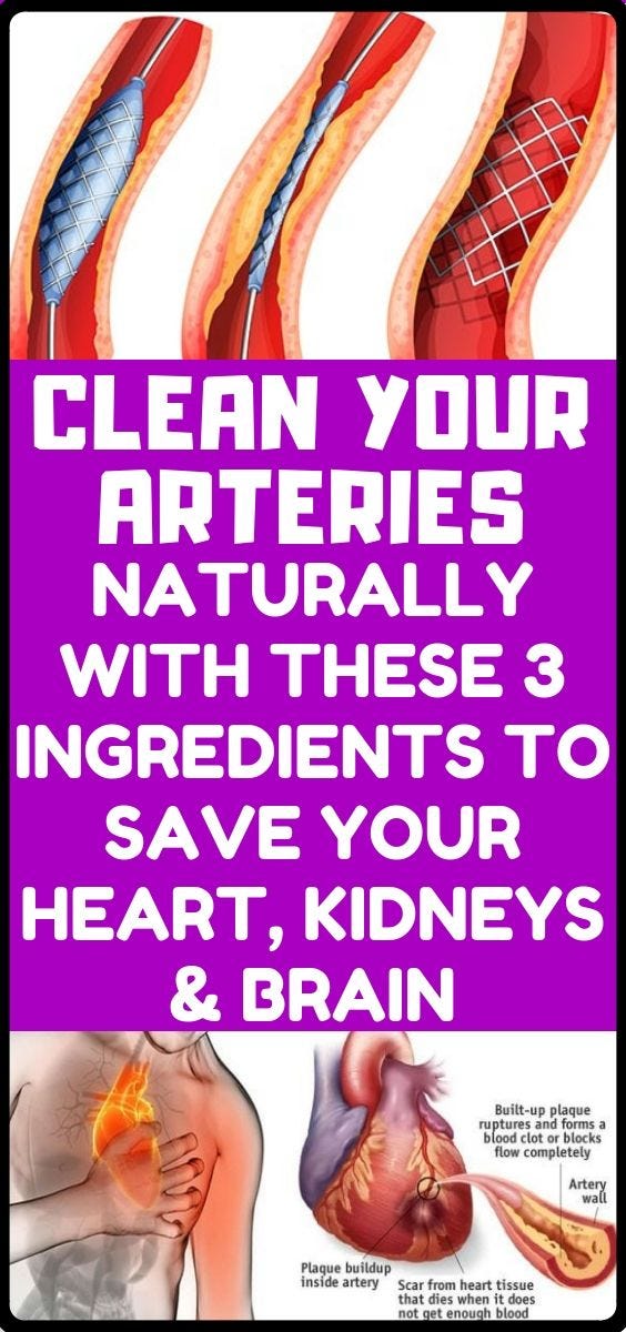 How to clean out plaque in arteries 3 ingredients mixture | by Rosa ...