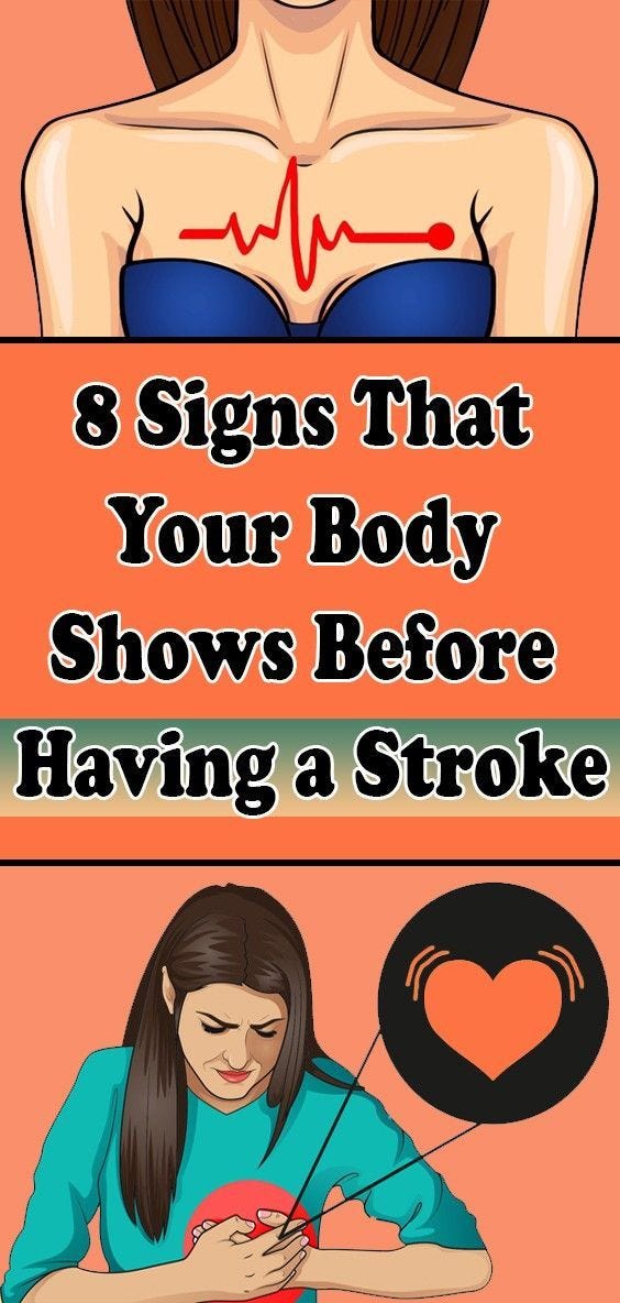8 signs that your body shows before having a stroke - Marselinoc lisa ...
