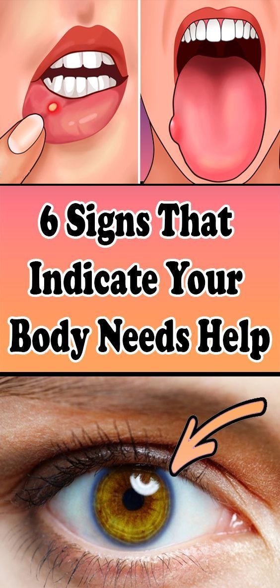 6 signs that indicate your body needs help - Marlenne laticia - Medium