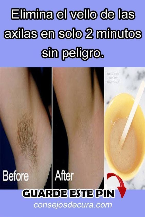 elimina el vello de las axilas en solo 2 minutos sin peligo - Pinterest ...