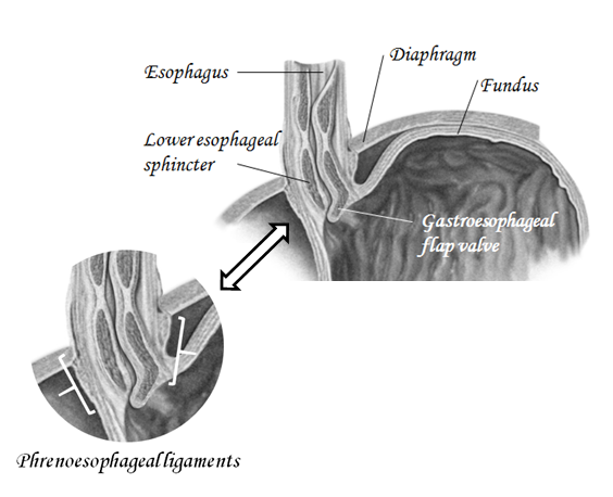 Anti-Reflux barrier — How does your body prevent acid reflux? | by Ali ...