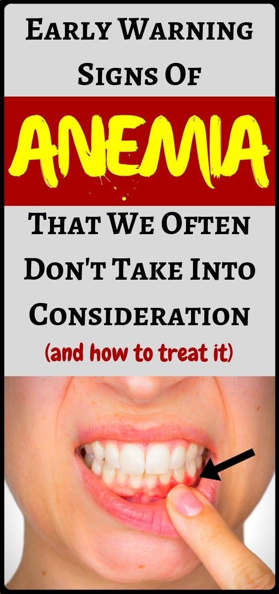 7 Signs of Anemia That You May Not Be Aware Of And How To Treat It ...