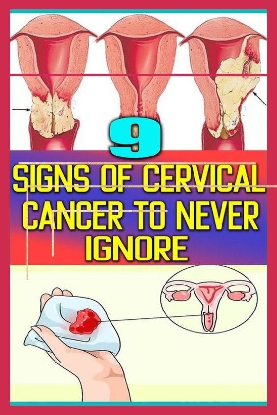 9 SIGNS OF CERVICAL CANCER TO NEVER IGNORE - natasha lik - Medium