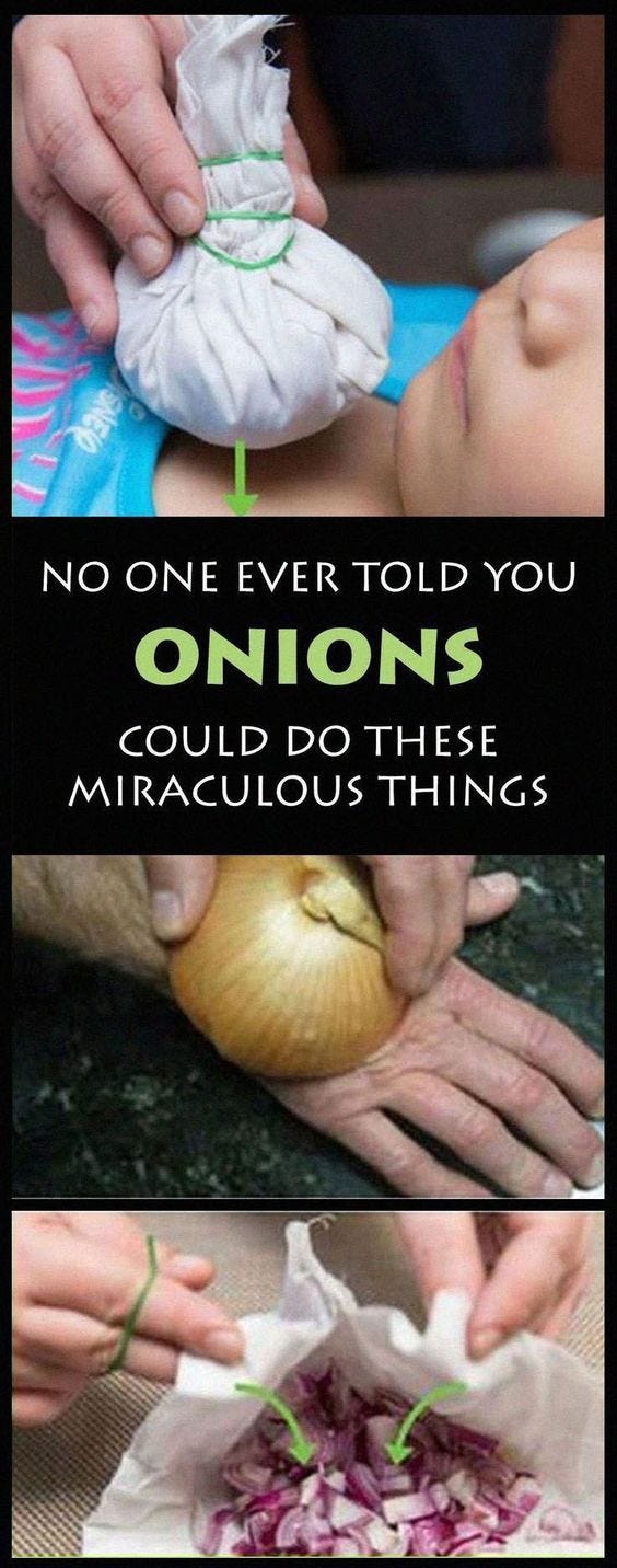 No One Ever Told You Onions Could Do These Miraculous Things - Joel ...