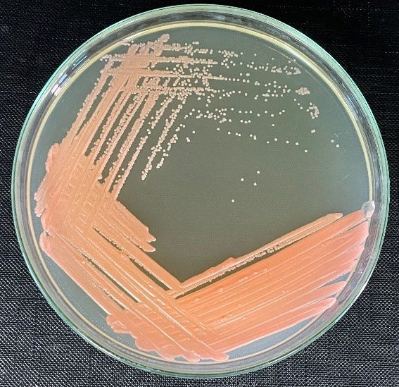Rhodotorula spp.. Rhodotorula spp เป็นยีสต์อยู่ใน Phylum… | by Potjaman ...