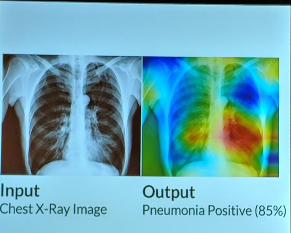 Application of Computer vision in Health care | by Anushka Srivastava ...