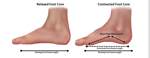 Fixing the Flat Foot — Flexible Flat Foot and Intrinsic Foot Muscles ...
