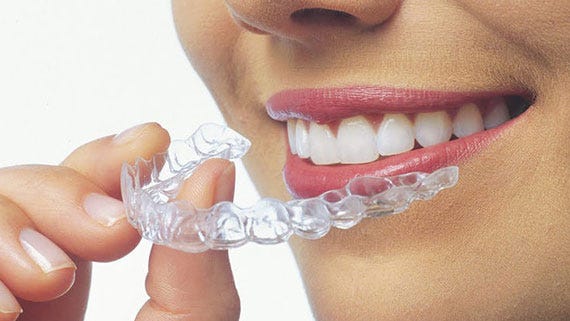 8 things you need to know about invisible retainers | by Monica Wills ...