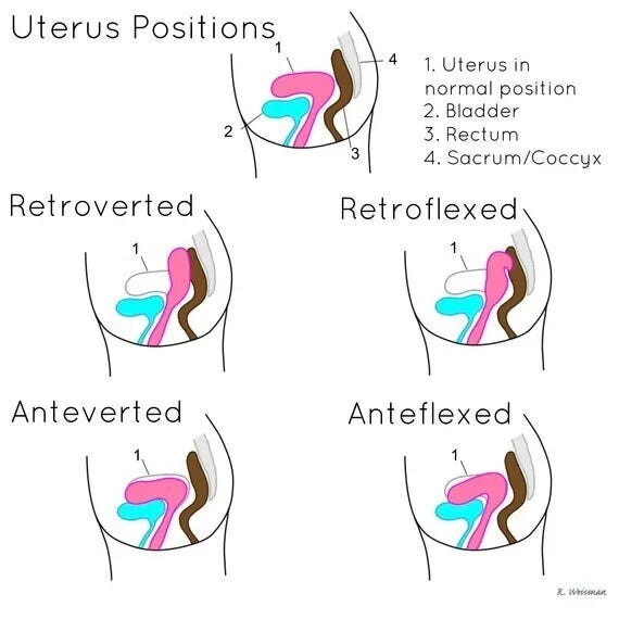 Could the Way You Sit Be Causing Your Period Pain? | by Adrian Farrell | Medium