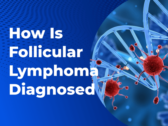 How is Follicular lymphoma treated | by Stephen Miller | Medium