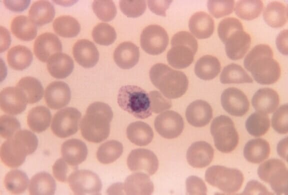 Identifying Dog Anaplasmosis Symptoms | by Symptom Finder | Medium