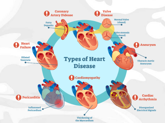Different Diseases in Cardiology. An Overview of Heart and Vascular ...