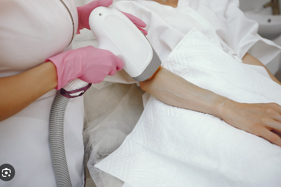 Exploring Laser Scar Removal: What to Expect and is it Right for You ...