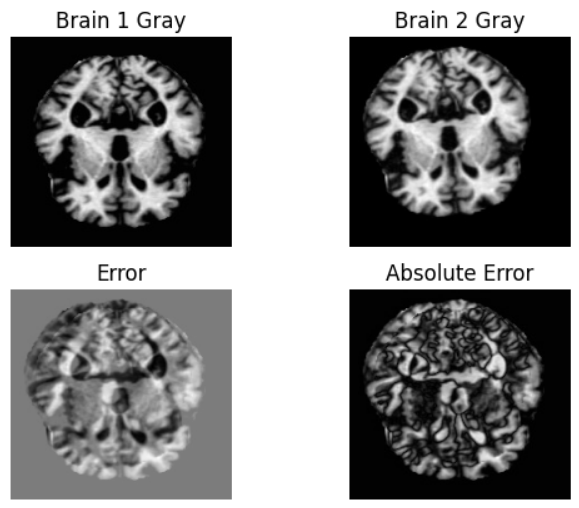 Biomedical Image Analysis Part 7— Comparing Images and Normalizing ...