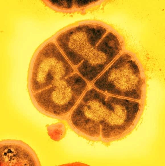 What Extremophiles Reveal About the Possibilities of Alien Life | by ...