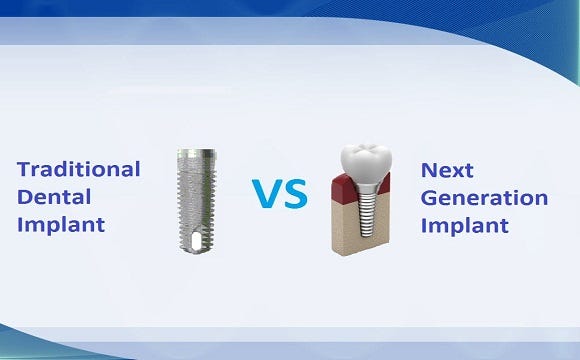 Traditional Vs Next Gen Implants: What’s the Difference? | by Dr ...
