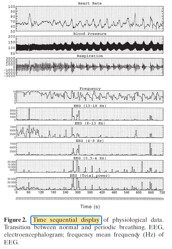 Brief Review — Development of the polysomnographic database on CD-ROM ...