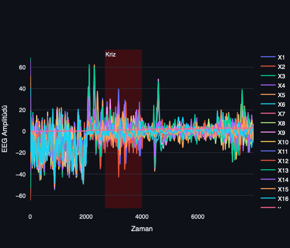 Building an Interactive EEG Epilepsy Dashboard with XGBoost | by ...