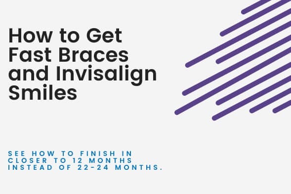 How to Get Fast Braces and Invisalign Smiles | by Dr. Todd Dickerson ...