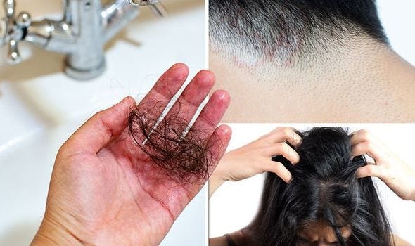Women Hair/home treatment of hair diseases Tinea Capitis. Tinea capitis ...