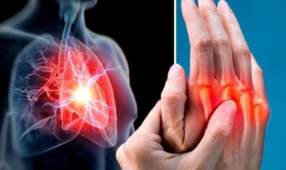 Arthritis and heart disease. Introduction | by princess bita | Jul, 2023 | Medium