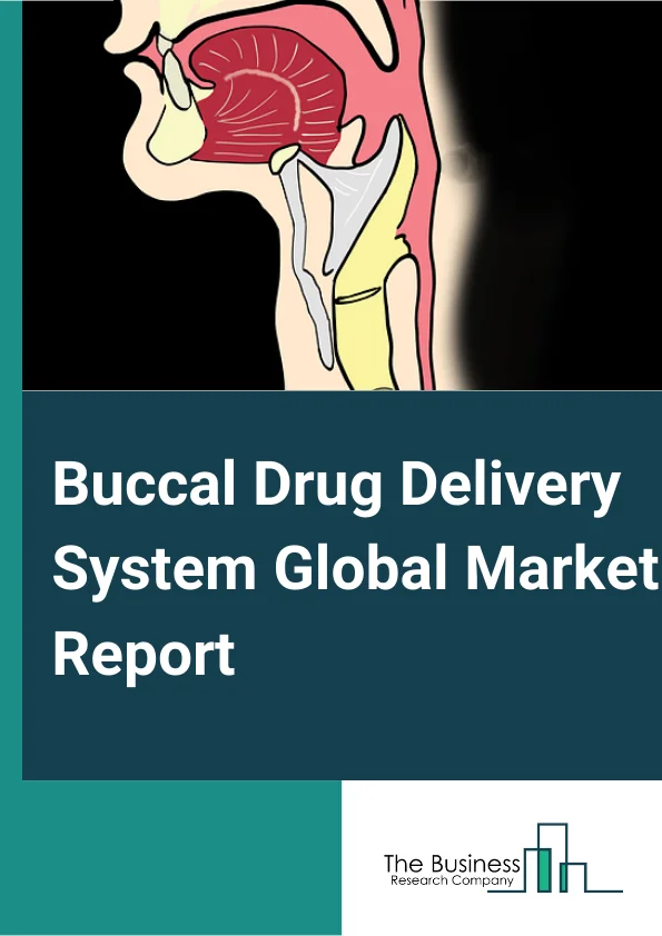 Buccal Drug Delivery Systems Market Size | by Sam Lutherford | Jan ...