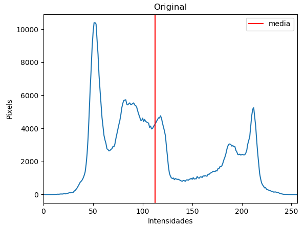 Histogram Equalization In Python With Opencv” By Antonio Alfonso Martinez Medium
