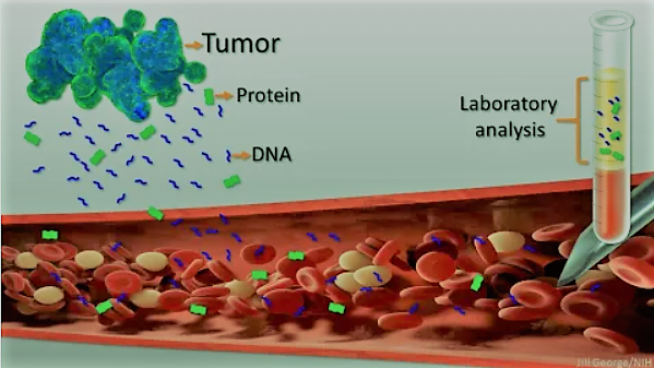 The future of Cancer Detection. Cancer, a disease in which some of the ...