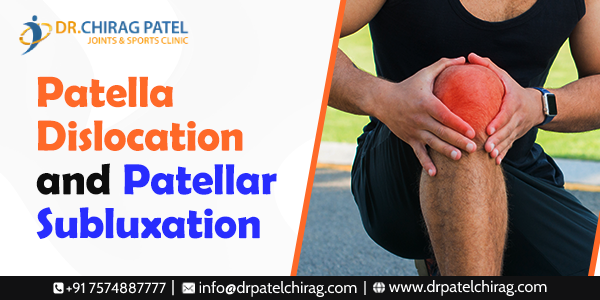 Patella Dislocation and Patellar Subluxation | by Drchiragpatelwebaccts ...