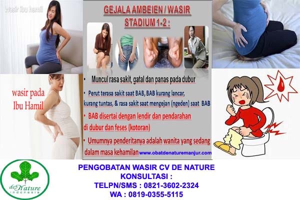 Cara menghilangkan dan obat wasir tingkat/stadium 4 di apotik paling ...