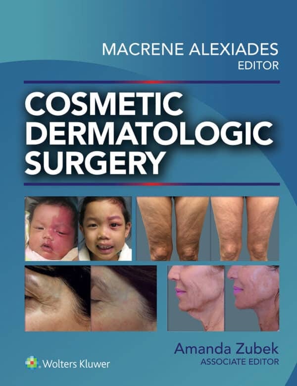 Cosmetic Dermatologic Surgery — eBook ZIP | by Univpdf | Medium