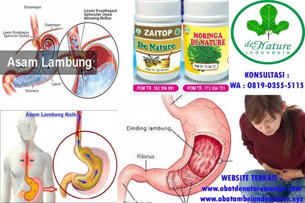 kumpulan Obat Sakit Perut Melilit Yang Sangat Ampuh | by Ratna Anjani ...