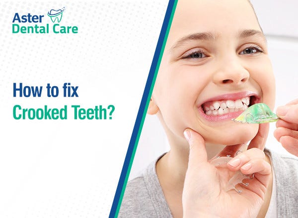 How To Fix Crooked Teeth?. Teeth that are misaligned, crooked, or… | by ...
