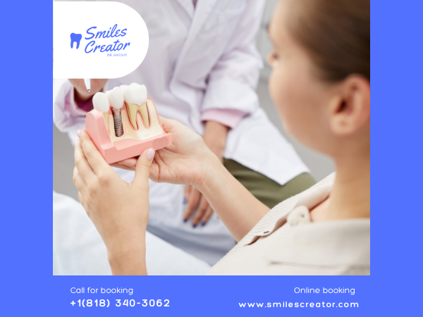 Discover Cutting-Edge Dental Implants Technology with Smiles Creator ...