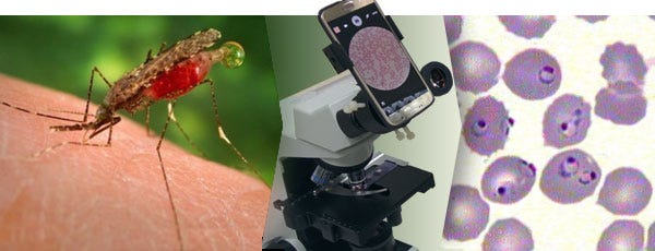 Malaria Cells Image Classification with Residual Neural Network | by ...