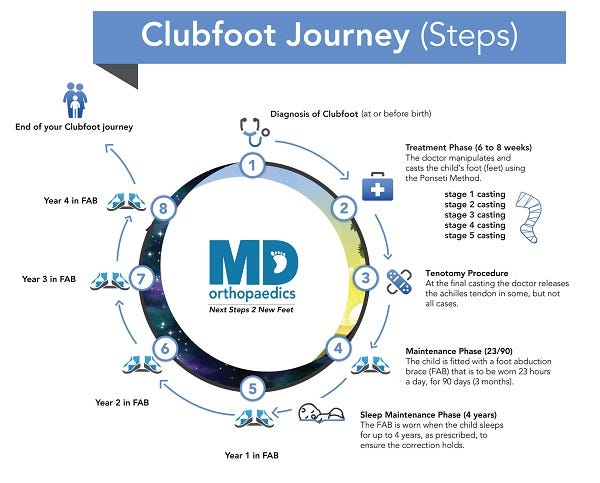 What is the most common method of treatment for clubfoot? - Thomas ...