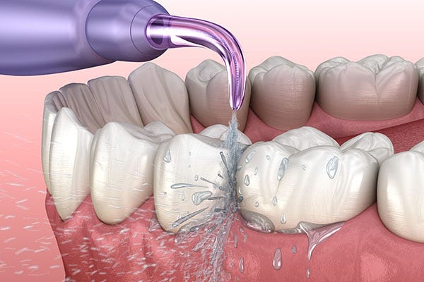 Why We Have So Many Problems with Our Teeth | by John S | Jan, 2024 ...