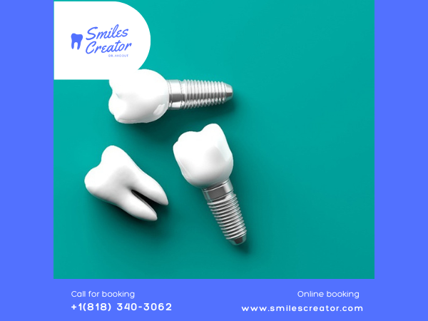 Rediscover Your Smile with Smiles Creator: Expert Implant Dentist ...