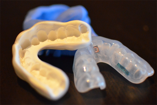 Level Up Your Game with Custom Fierce Mouthguards | by River City ...